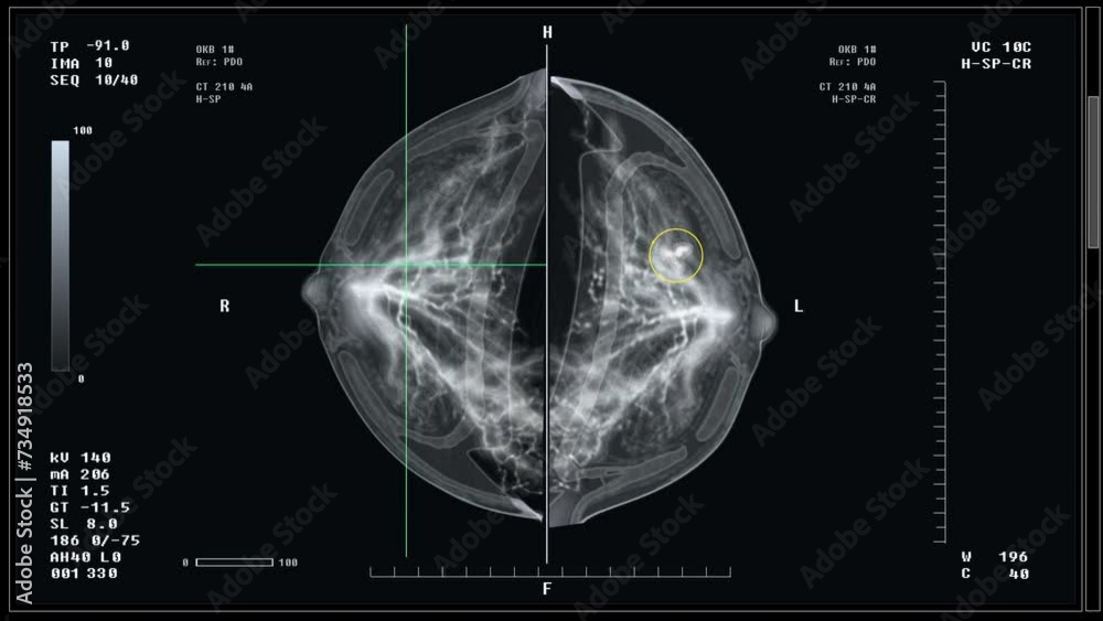 Diagnostic imaging test at the healthcare hospital. Diagnostic imaging ...