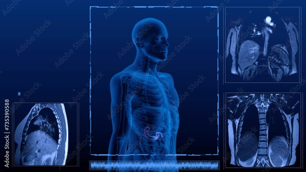 Magnetic resonance tomography scan in different projections of the ...