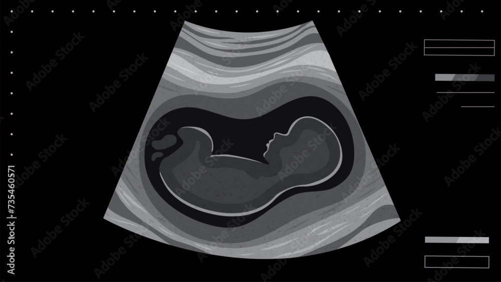 Ultrasound scan of baby vector illustration. Cartoon pregnancy ...