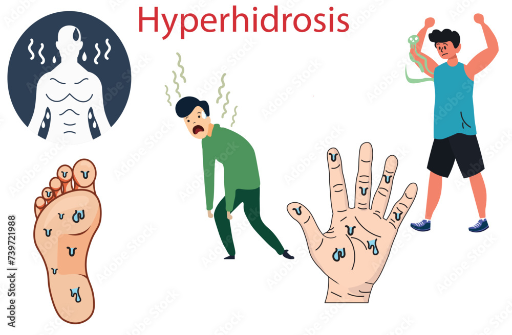hyperhidrosis,person sweats excessively,The sweating of armpits,palms ...