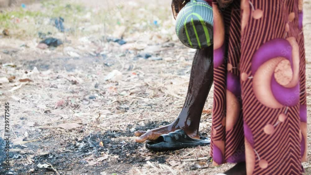 9 jan. 2024,Gwalada,Nigeria: close up of Malnourished child due to ...