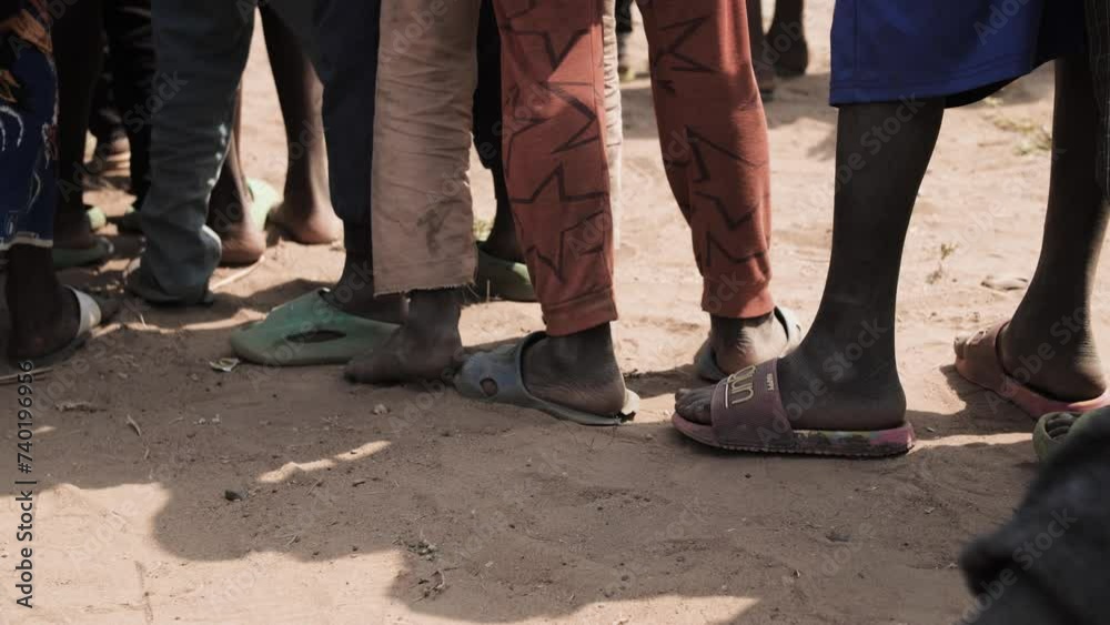 19 jan. 2024,Gwalada,Nigeria: Close up of Malnourished child due to ...