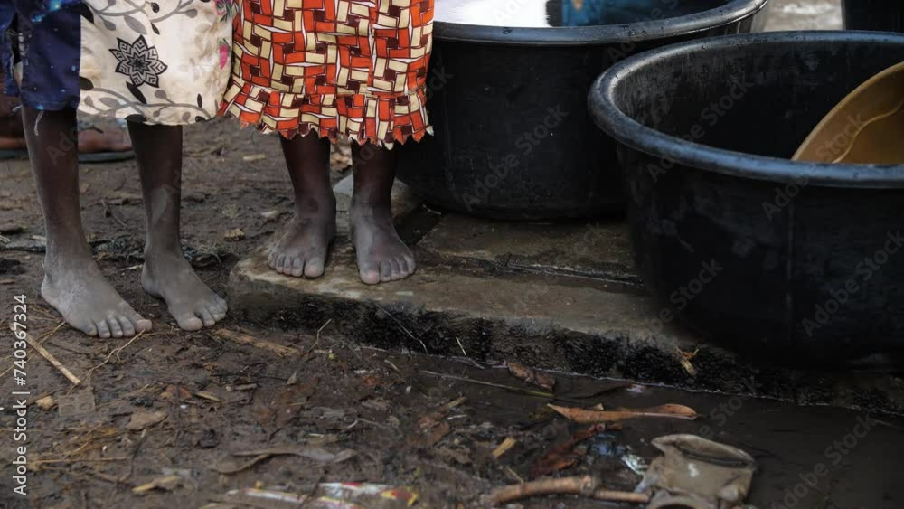19 jan. 2024,Gwalada,Nigeria: Close up of Malnourished child due to ...