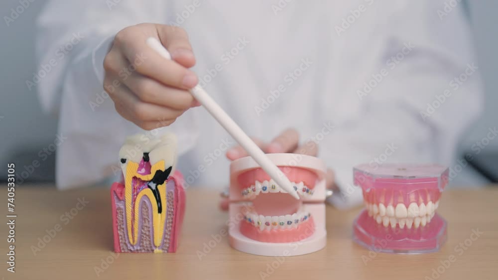 Tooth Anatomy and Orthodontic model on dentist table. Oral Teeth and ...