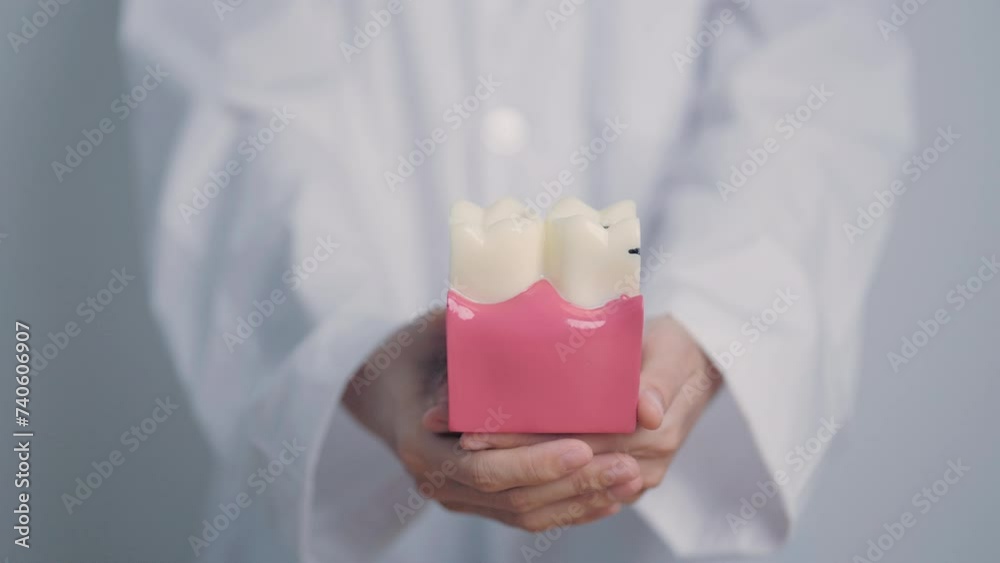 Dentist with tooth Anatomy model. Oral Teeth decay and disease, Scrape ...