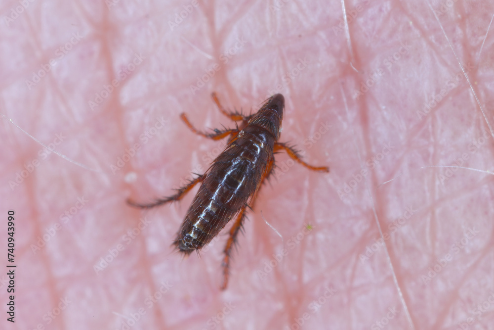 A flea biting on the skin of human hand, drinking blood. A nuisance ...