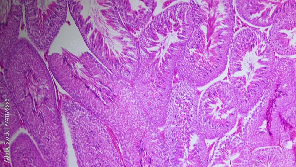 Testes. Microanatomy. Male gonads, the formation of male sex cells ...