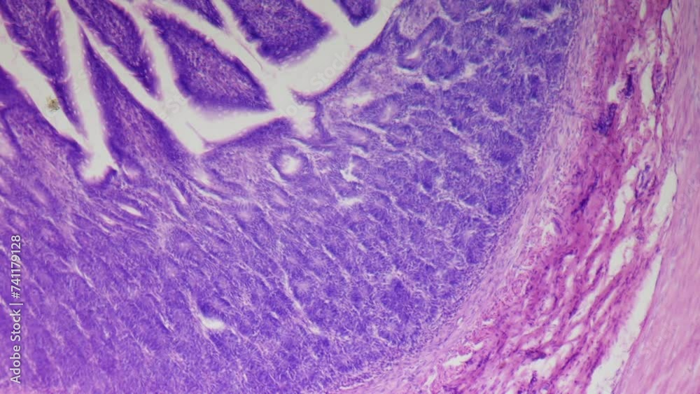 Large intestine (Colon) under microscope, the terminal part of the ...