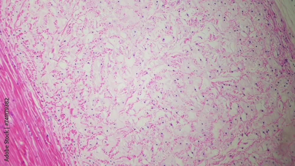 Tendon under microscope. 100x magnification. Connective tissue and ...