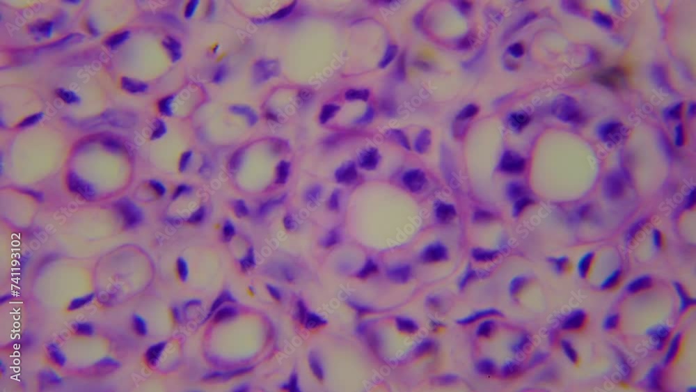 The human kidney. Microanatomy. Cross section of kidney. 1000x ...