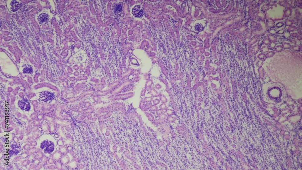 The human kidney. Microanatomy. Transverse section of a mammalian ...