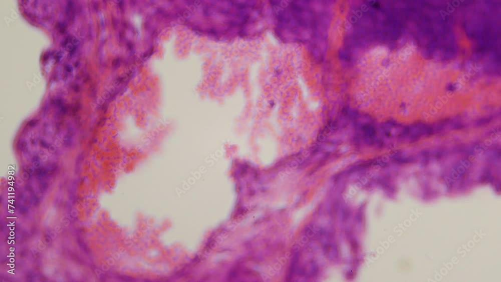 Mammalian uterus. Microanatomy. Uterine biopsy section. 1000x ...