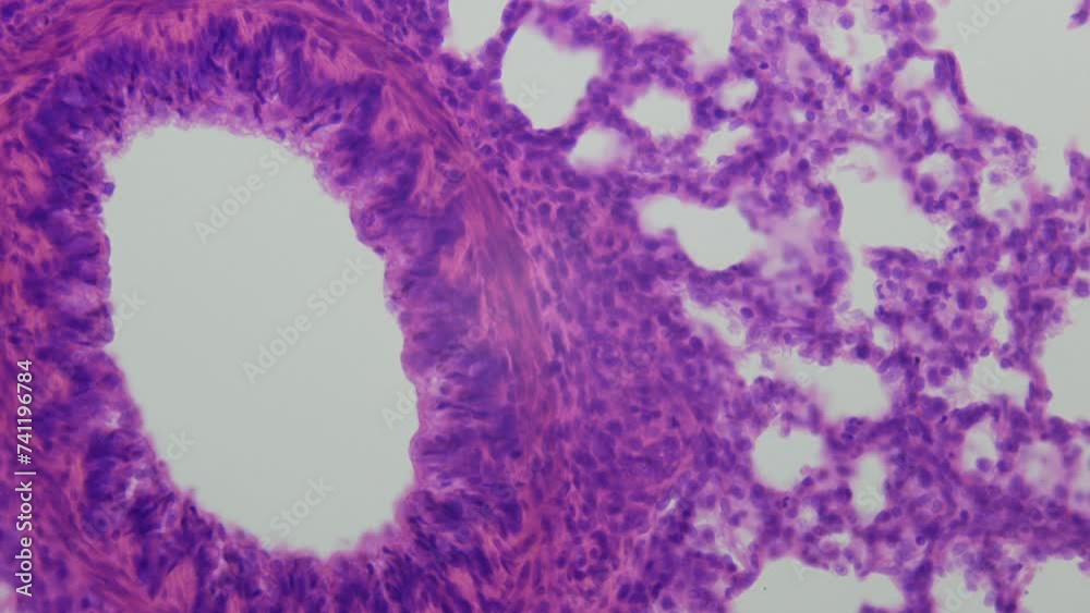 Lungs. Microanatomy. 400x times magnification. Porous structure of ...