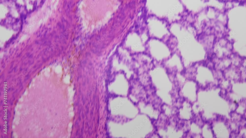 Lungs. 400x magnification. Microanatomy. Porous structure of human ...