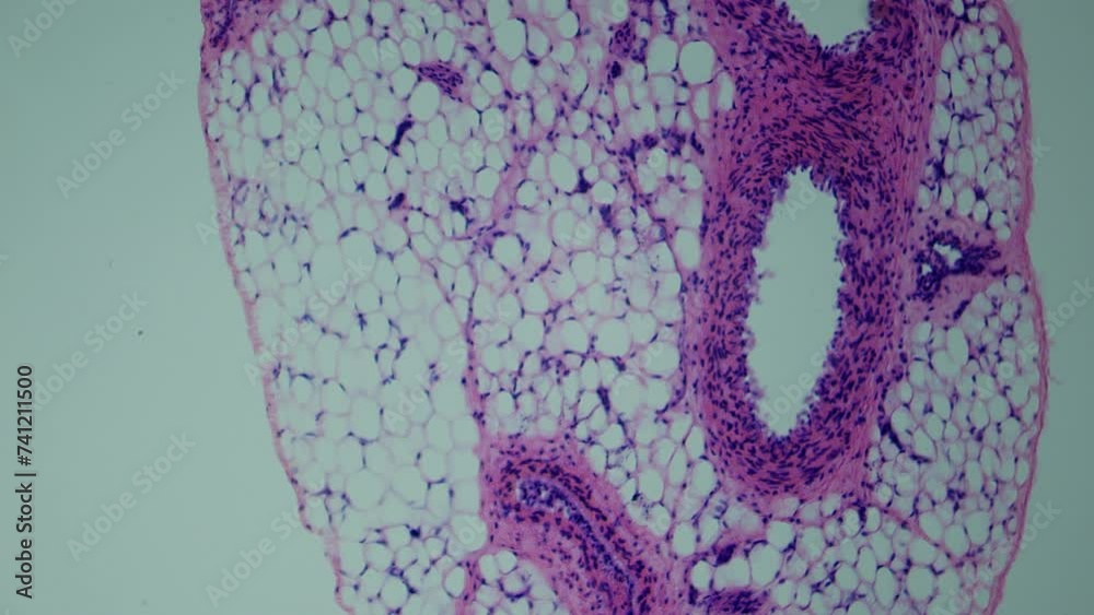 Vidéo Stock Angiology Lab. Examination of the cross section of vessels ...