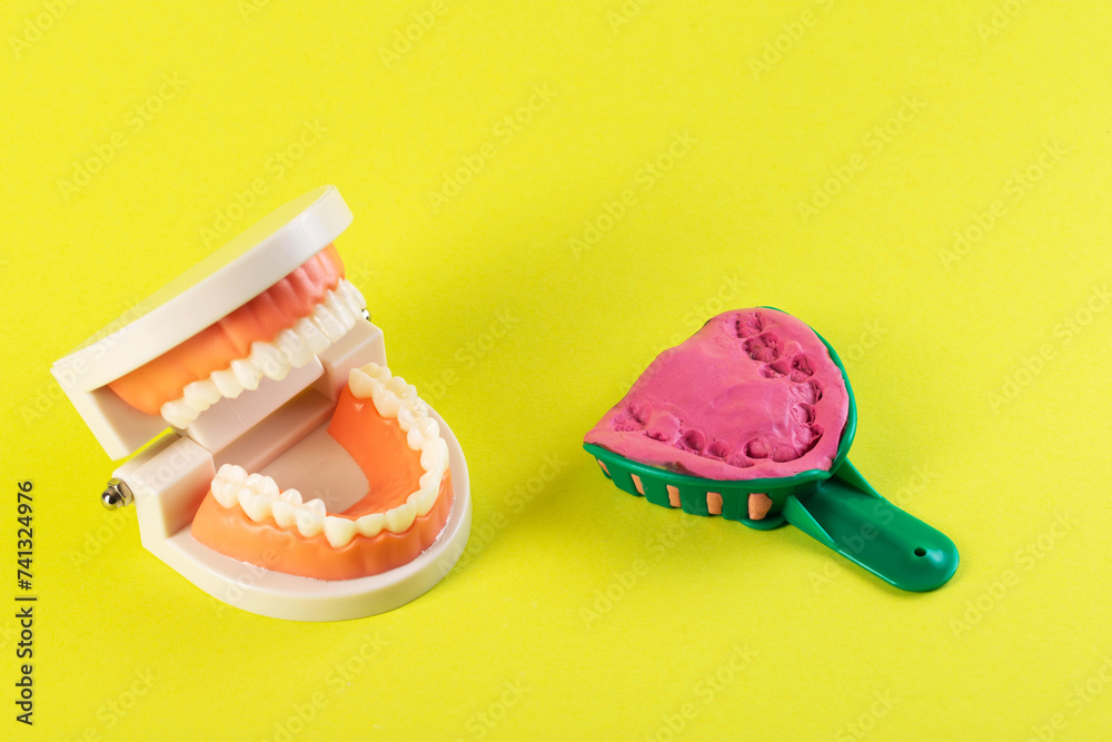 Green dental spoon for taking a dental impression in a mock-up of a ...