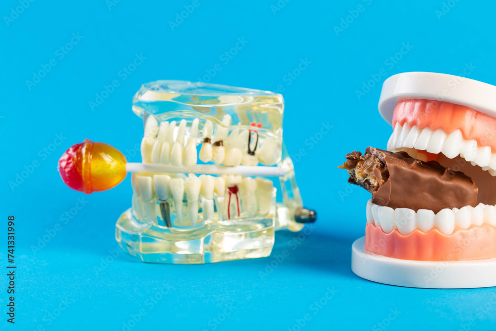 Two mock-ups of dental jaws with a lollipop and a chocolate bar on a ...