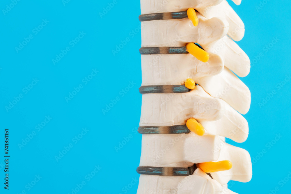 Mockup of the spine on a blue background. Concept of intercostal ...