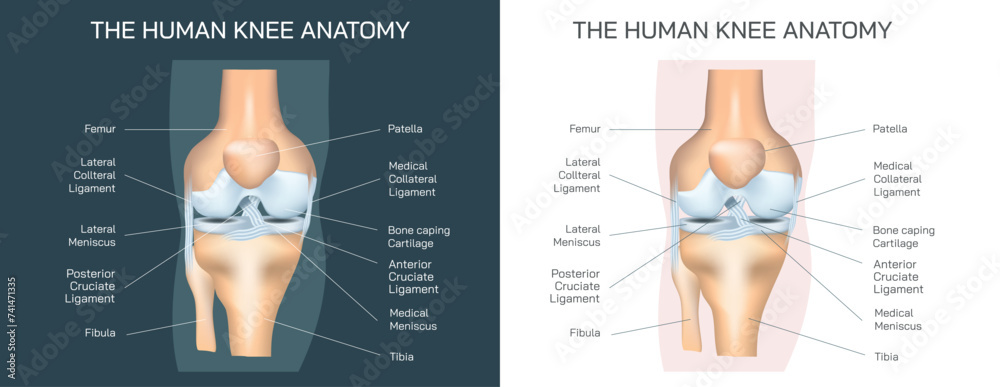 The human knee anatomy vector illustration. Common knee problems ...