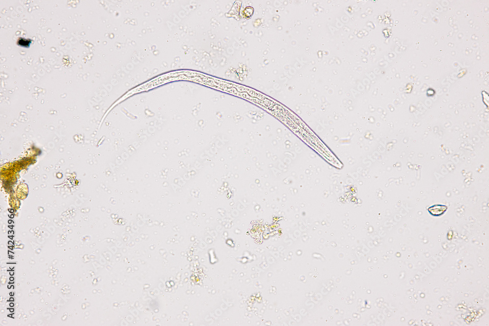 Finding Trichuris trichiura egg and Strongyloides egg in the feces ...