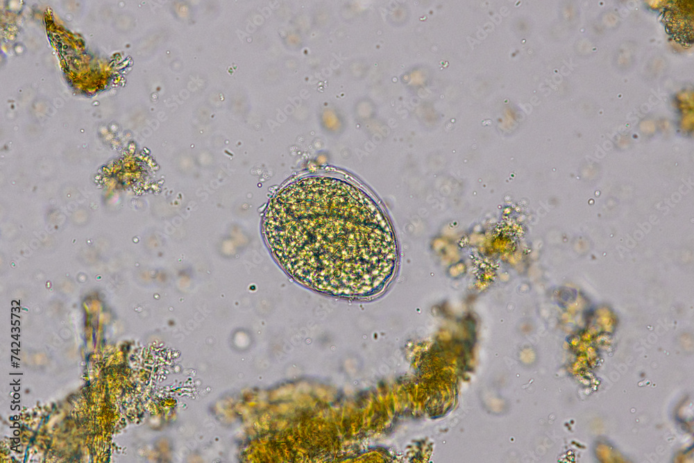 Finding Trichuris trichiura egg and Strongyloides egg in the feces ...
