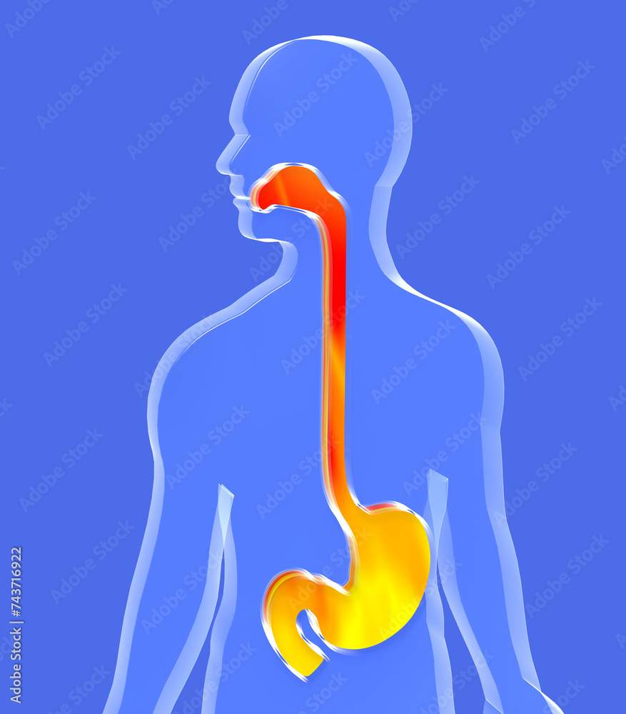 3d illustration of stomach and esophagus to the mouth with indigestion ...