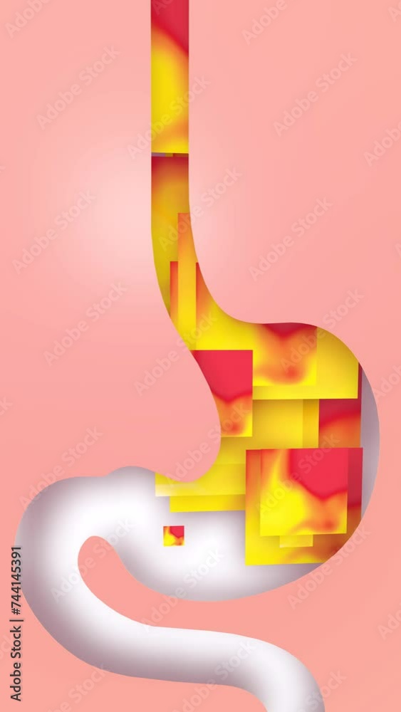 3d animation of stomach with rectangles of fire inside. Moving up ...