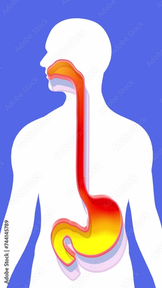 3d animation of stomach and esophagus to the mouth with fire. Reflux ...