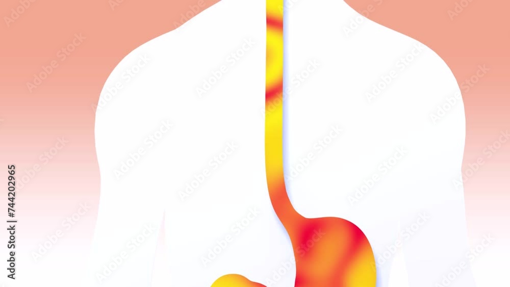 3d animation of fire digestive system over human silhouette. Esophagus ...