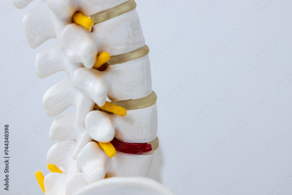 Isolated anatomy spine model on white space background.Orthopedic ...
