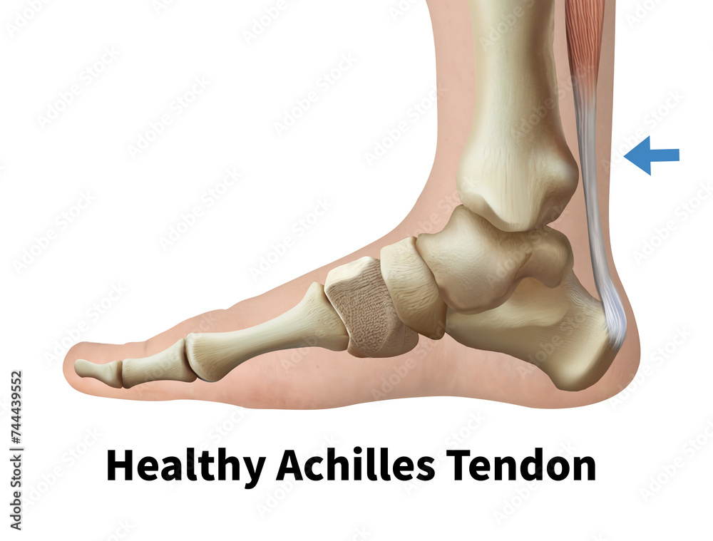 Healthy foot and ankle bone and Achilles tendon medical illustration ...