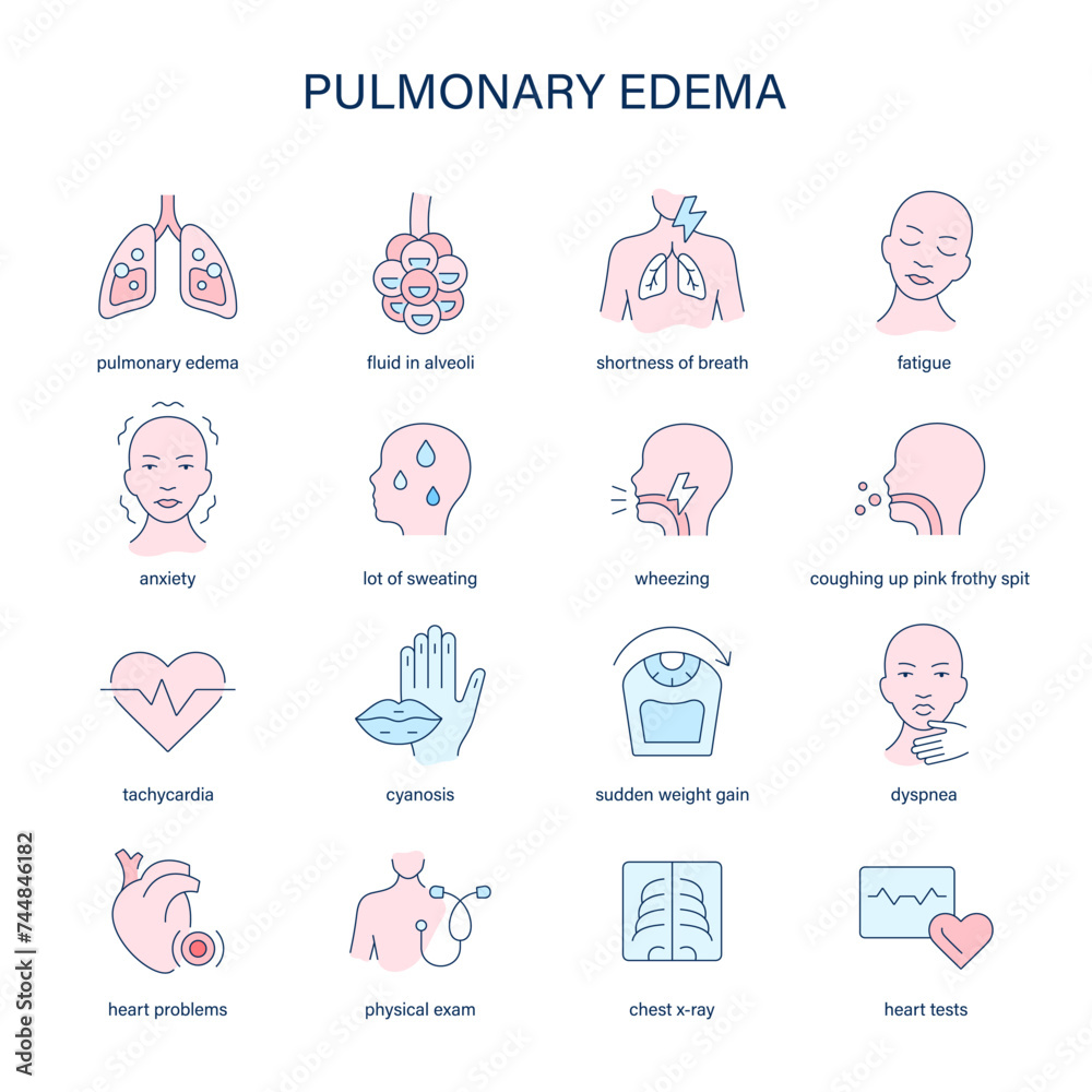 Pulmonary Edema symptoms, diagnostic and treatment vector icons ...