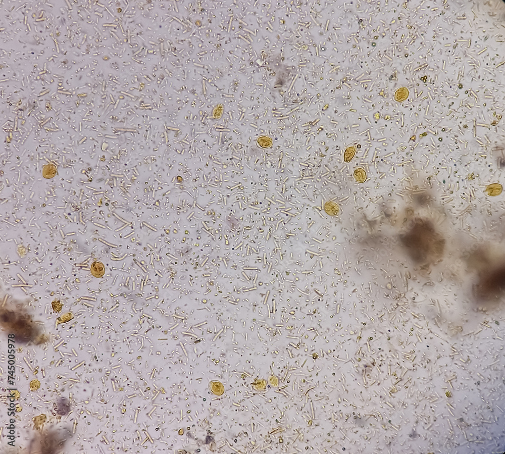 Giardia lamblia cysts and Trophozoite form, muscle fiber in stool ...