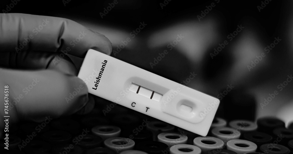 Blood sample of patient positive tested for leishmaniasis by rapid ...