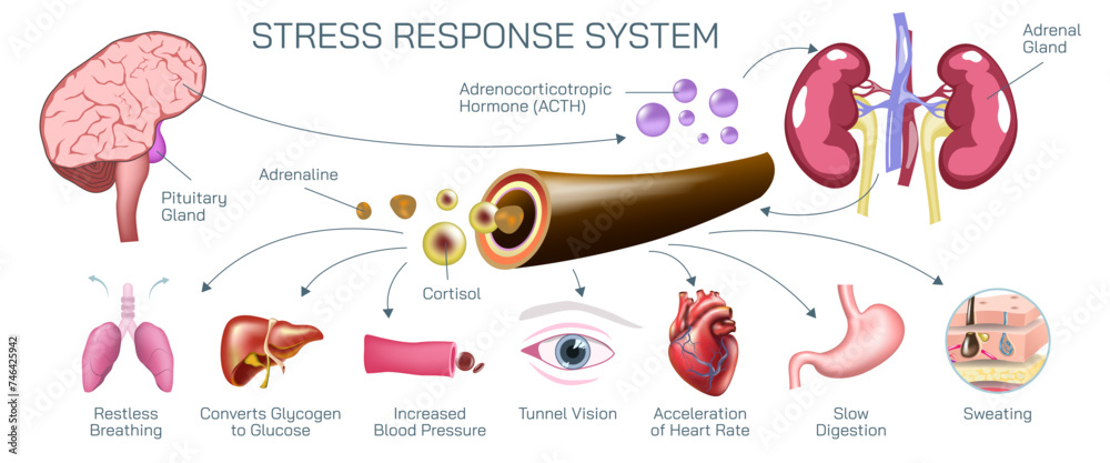 What is Stress response system vector illustration. A stressful ...