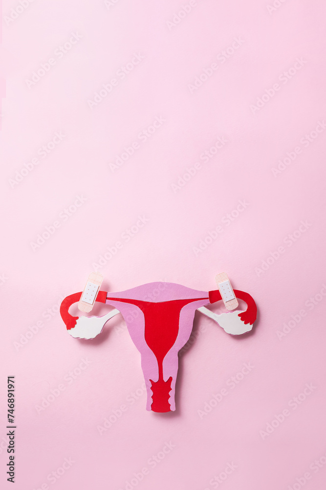 Papercut anatomical structure of female uterus with adhesive plasters ...