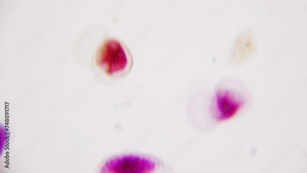 Plant pollen under microscope, 1000x. Different examples of pollen from ...