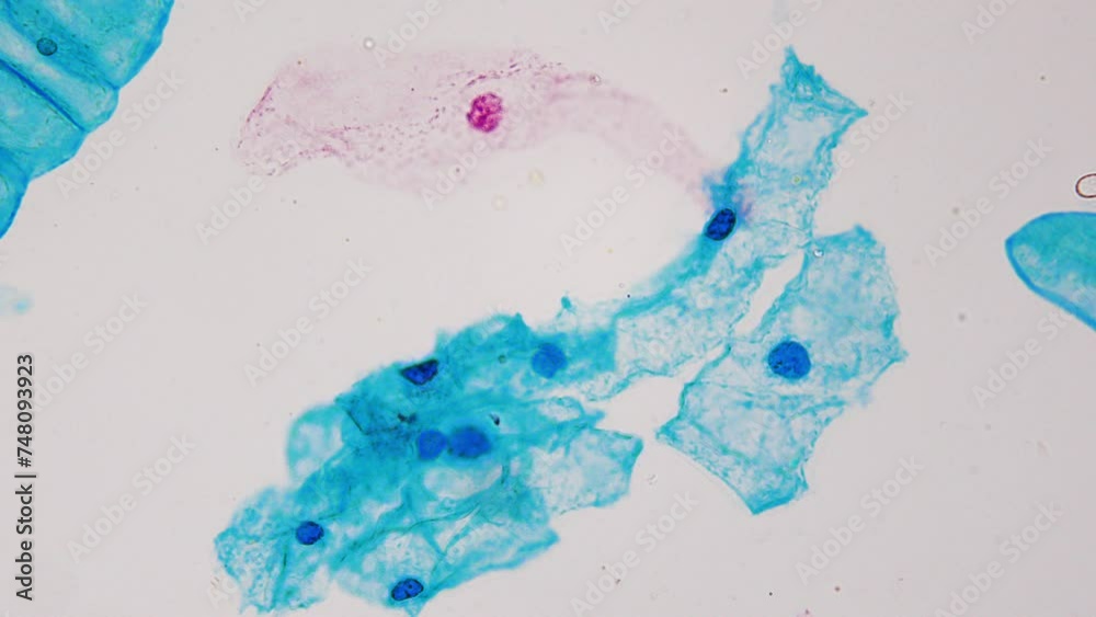 Pepper under the microscope, 400x. Capsaicin. Effect of pepper on speed ...