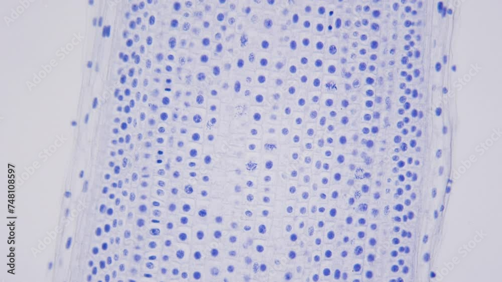 Intensive growth zone of plant. Onion root under microscope ...