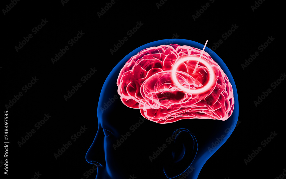 Brain scan image or hologram rotates 360 degrees. Light attacks in wave ...