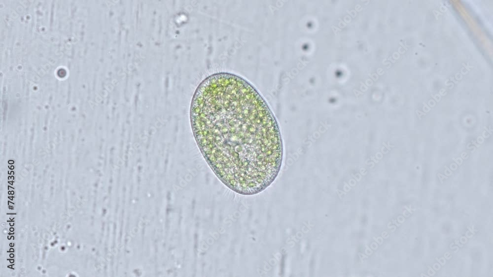 paramecium bursaria showing spherical algae of the genus Chlorella in ...