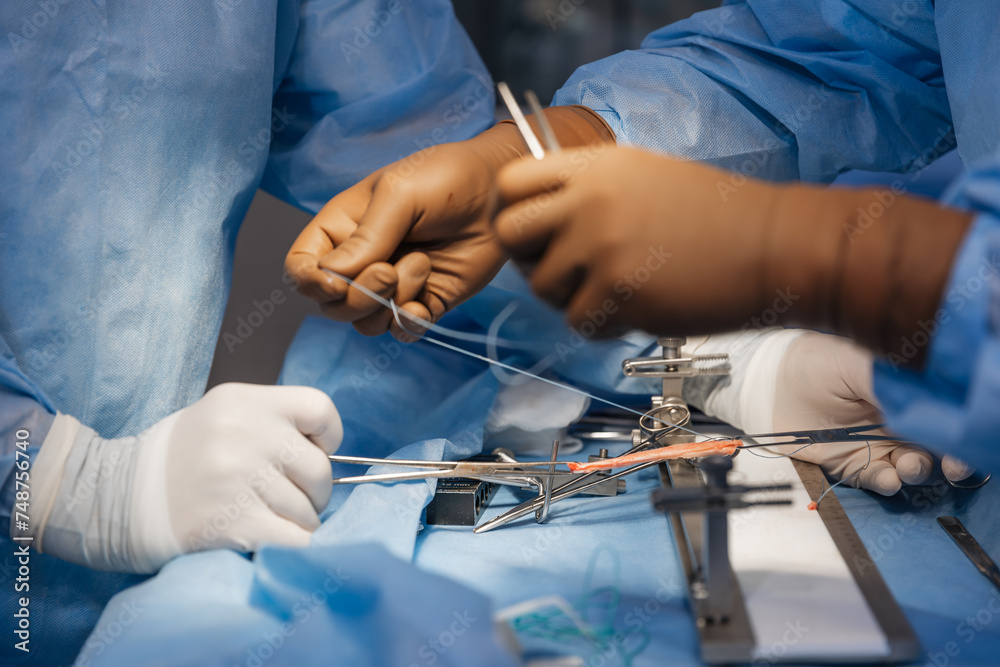 surgeons work on the cut part of the knee joint (muscular ligament ...