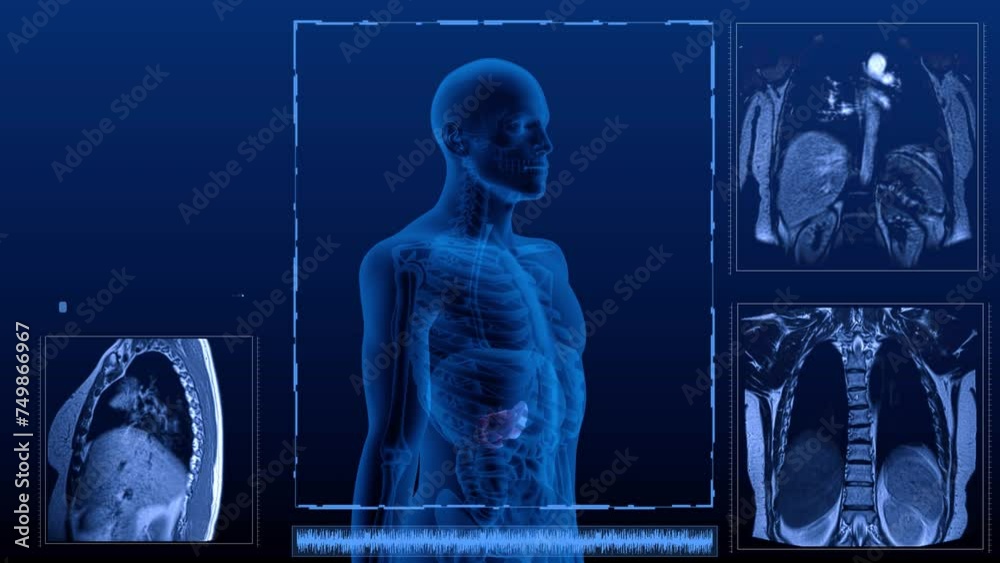Magnetic resonance tomography scan in different projections of the ...