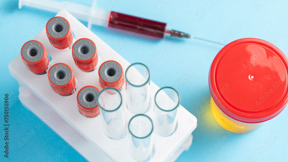 urine and blood samples for test close-up, A row of human samples for ...