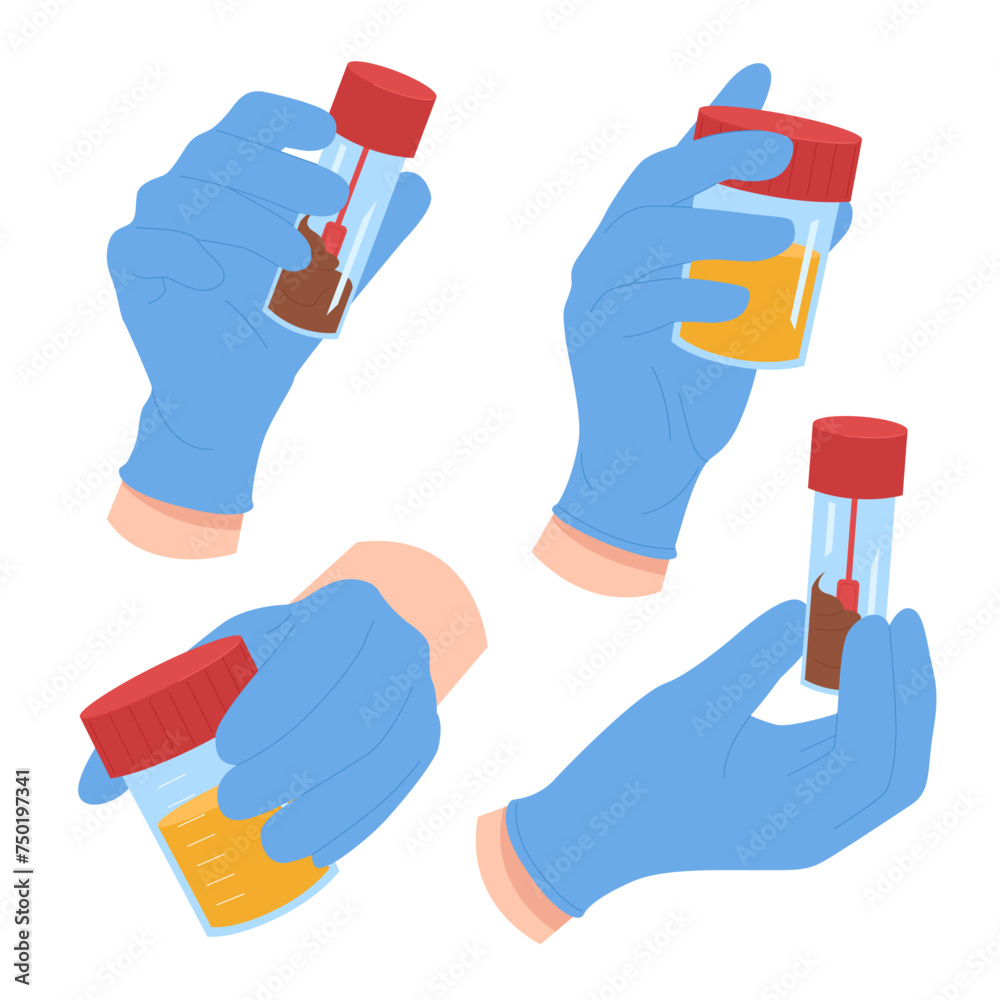 Laboratory analysis of urine and feces for medical clinical diagnosis ...