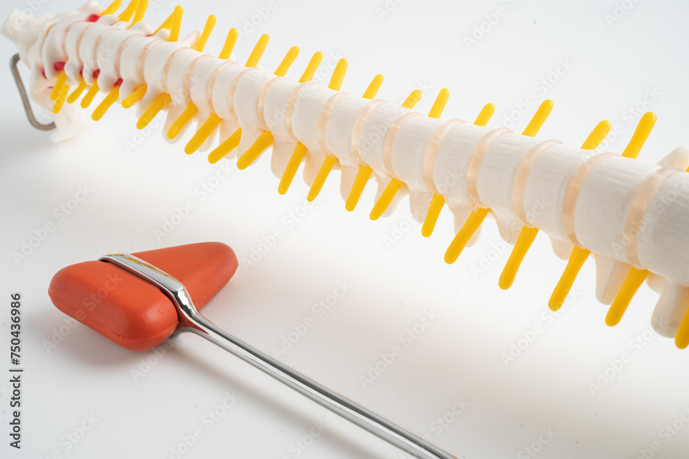 Human spinal nerve and bone with percussion reflex hammer, model for ...