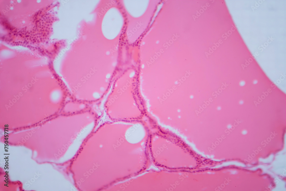 Thyroid gland under a microscope, light micrograph exhibiting typical ...