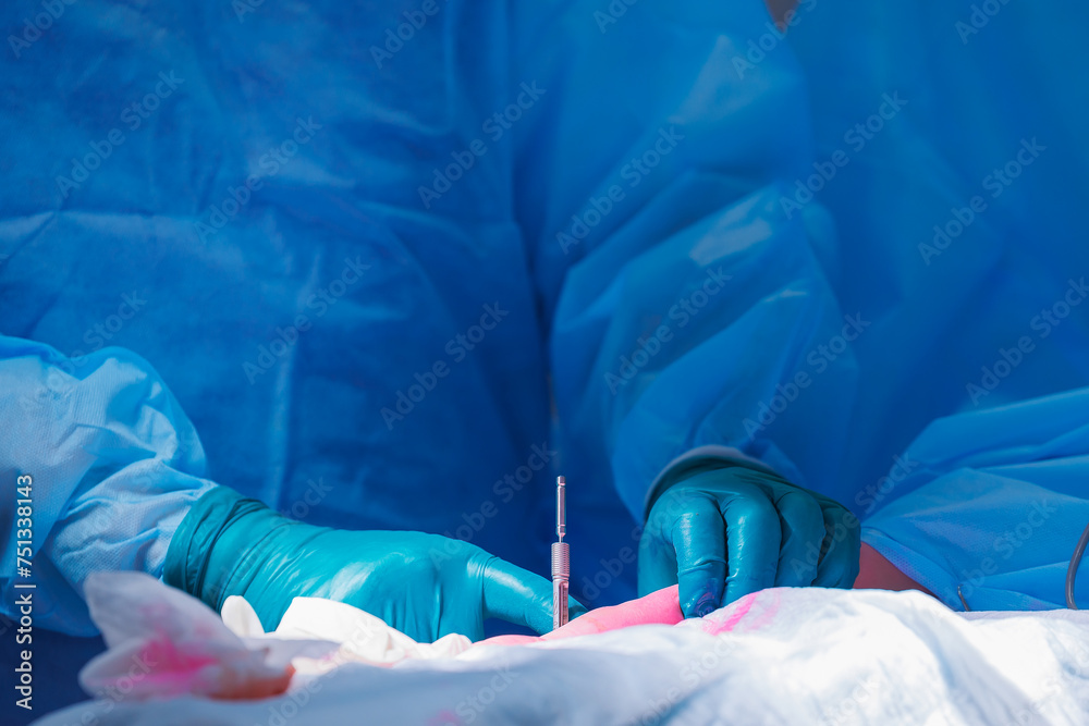 Surgery to restore patient arm in clinic. Surgeon installs metal screw ...