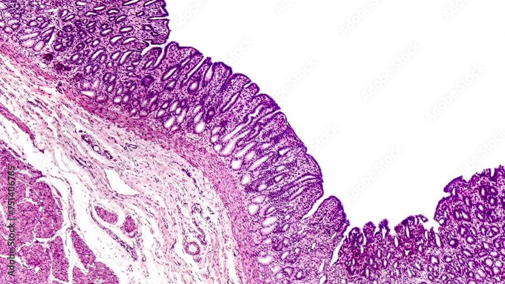 Light micrograph footage showing a cross-section of the stomach ...