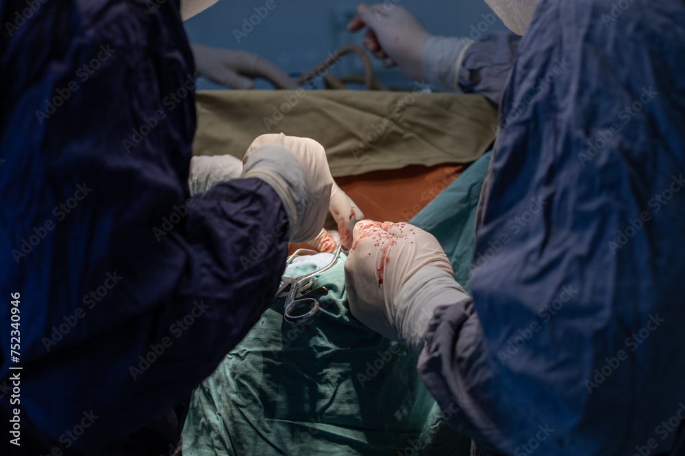 neurosurgeon , doing surgery, operation theater, subdural hematoma in ...